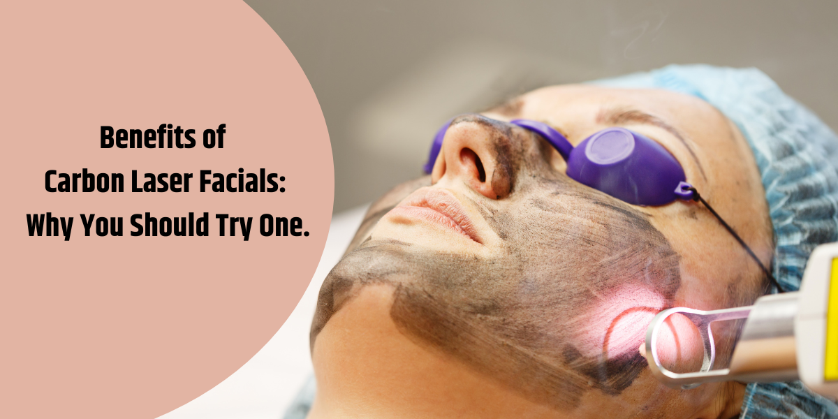 Benefits of Carbon Laser Facials: Why You Should Try One.